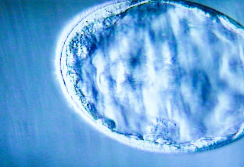 Blastocyst Grading System Ivfserum Advanced Ivf Treatment Center Greece